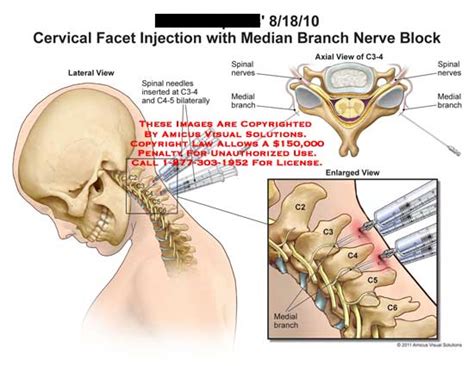 Medical Exhibits Demonstrative Aids Illustrations And Models