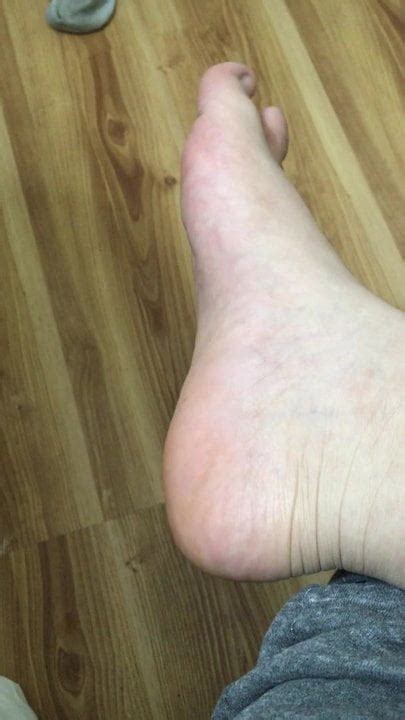 Pieds Mâles De 19 Ans Xhamster