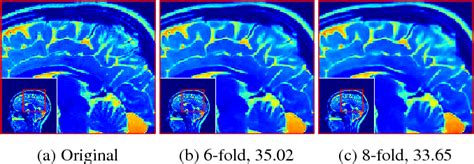 figure 4 from model based image reconstruction using deep learned
