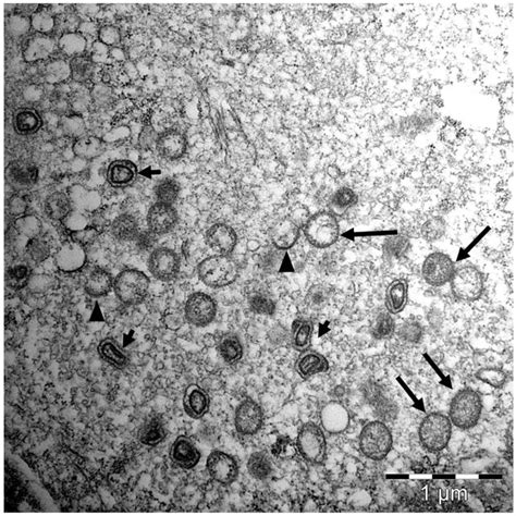 Transmission Electron Microscopy Of The Inside Of A Salmon Gill