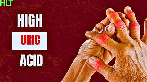 8 Proven Tips To Lower Uric Acid Levels Youtube