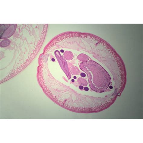 Ascaris Lumbricoides Female And Male Ts Medical And Science Media