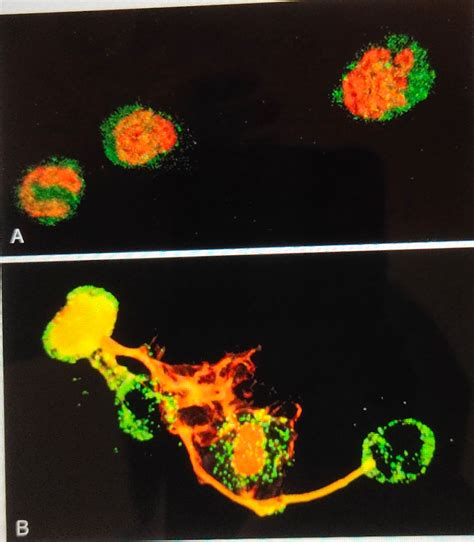 Neutrophil Extracellular Traps Made Me Sad Rmedicalschool