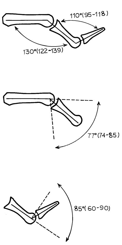 Median Range Of Motion Of The Control Osteotendinous Structure Above