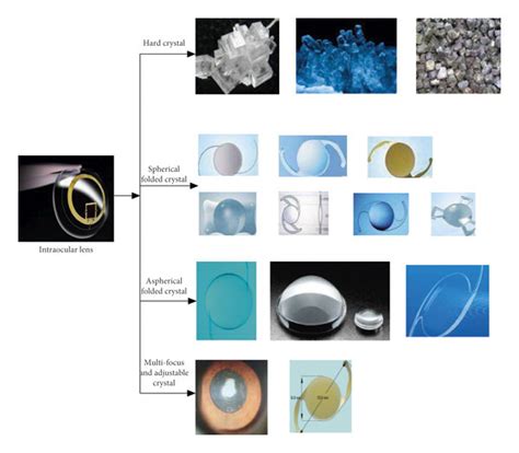 Specific Classification Of Intraocular Lenses Download Scientific
