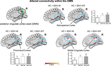 Differences In Connectivity With The Posterior Cingulate Cortex Seed Download Scientific