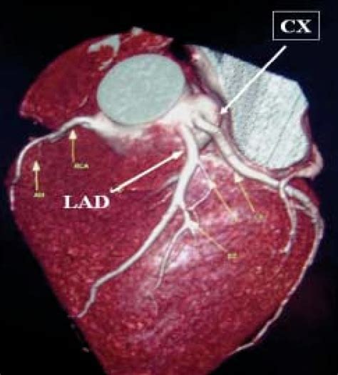 Separate Origins Vrt Image Shows Separate Origins Of The Lad And The Download Scientific
