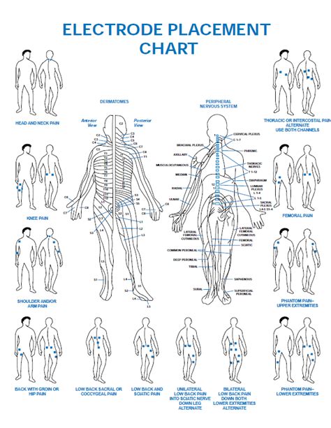 Placement Chart For Tens Unit Electrodes Educational Chart Resources