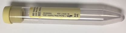 Urinalysis Microscopic Wakemed
