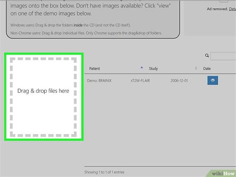 How To Open And View DICOM Files On A PC Or Mac