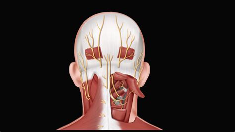 Occipital Neuralgia Tumour