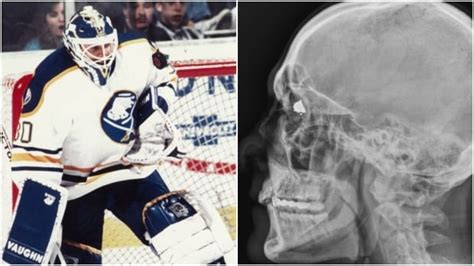 Clint Malarchuk Suffered A Horrific Sporting Injury But Ptsd Put His