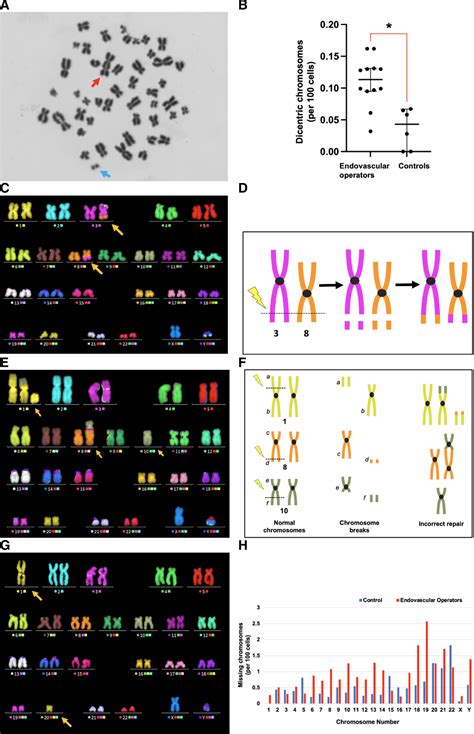Higher Incidence Of Chromosomal Aberrations In Operators Performing A Large Volume Of
