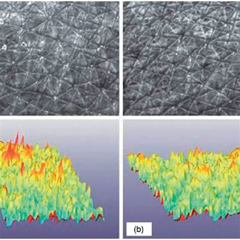 Increase In Skin Thickness Dermis And Epidermis A And Density B