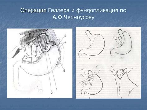Заболевания пищевода презентация онлайн