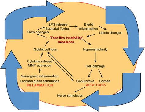 Diagnosing The Severity Of Dry Eye A Clear And Practical Algorithm