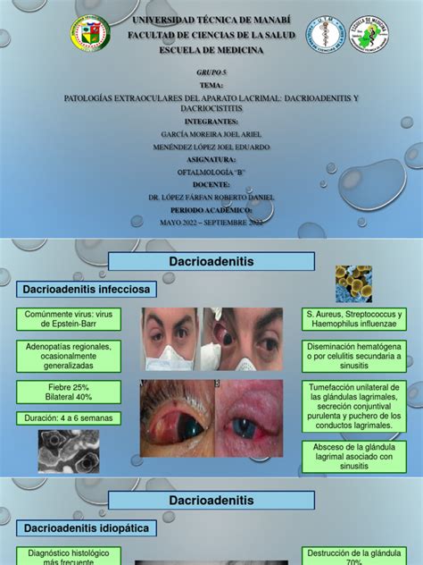 Grupo 5 Diapositivas Dacrioadenitis Y Dacriocistitis Pdf
