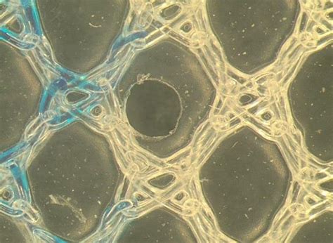 Hernia Mesh With Hole Fig2 Hernia Mesh Transparency Download