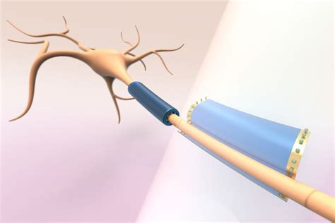 Microtech Ventures On Linkedin “wearable” Devices For Cells By Snugly