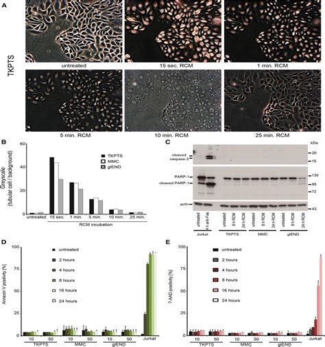 The Rip1 Kinase Inhibitor Necrostatin 1 Prevents Osmotic Nep