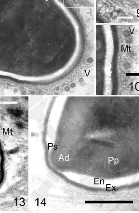 Ultrastructure Of Tubulinosema Maroccanus Tem Spores 8 Mature