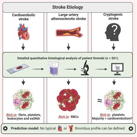 Association Between Thrombus Composition And Etiology In Patients With