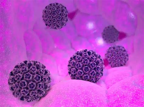 Hpv 16 18 Tedavisi Dr Esra DemİryÜzer