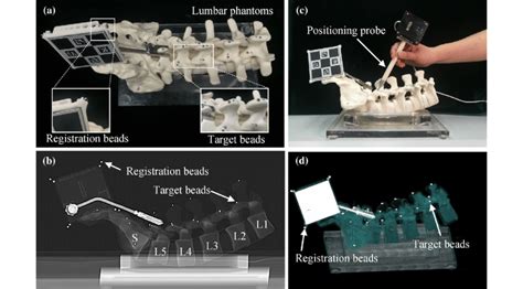 Registration Accuracy Verification Experiment A Lumbar Spine Phantom Download Scientific