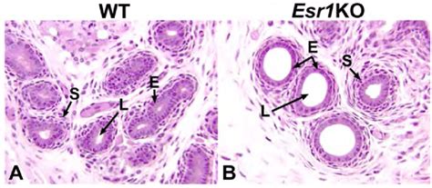Efferent Ductules From Pnd 6 Wild Type Wt And Esr1ko Mice A Wt