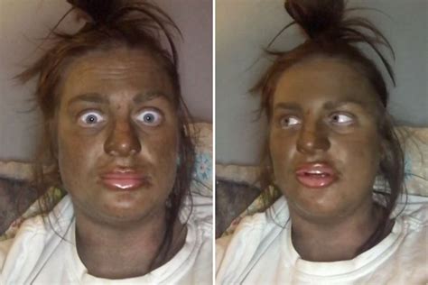 Woman Fears Worst Fake Tan Fail Ever After Piling On Layers Of St Moritz Dark When She Cried Off