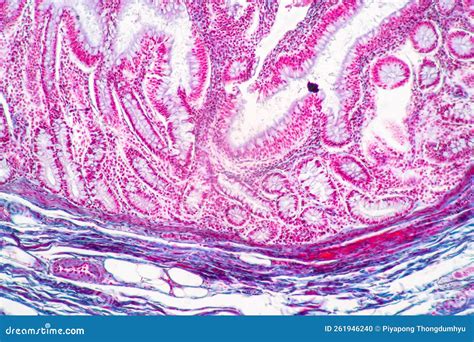 Tissue Of Stomach Human Small Intestine Human Pancreas Human And