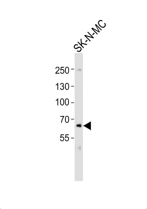 Pcsk9 Antibody C Term Purified Rabbit Polyclonal Antibody Pab Wb