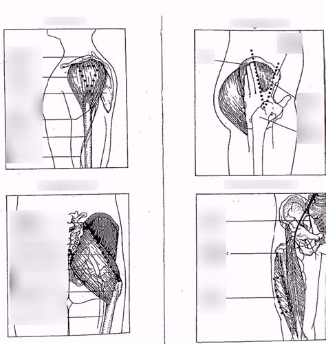 Intramuscular Injection Diagram