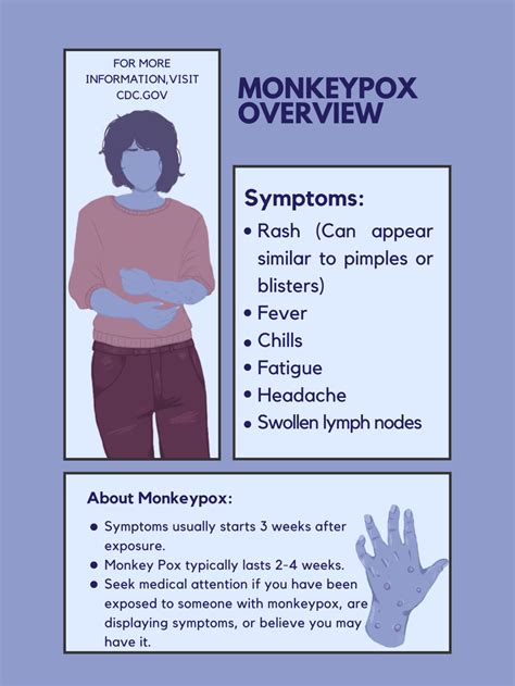 The New ‘cheese Touch Talk Of Monkeypox Epidemic Grows Vandegrift Voice