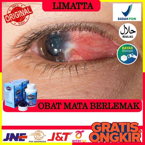 Jual Obat Mata Berlemak Mata Katarak Mata Berdarah Sakit Mata Mata
