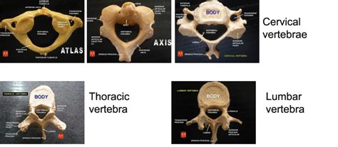 The Vertebral Column Human Anatomy And Physiology Lab Bsb 141