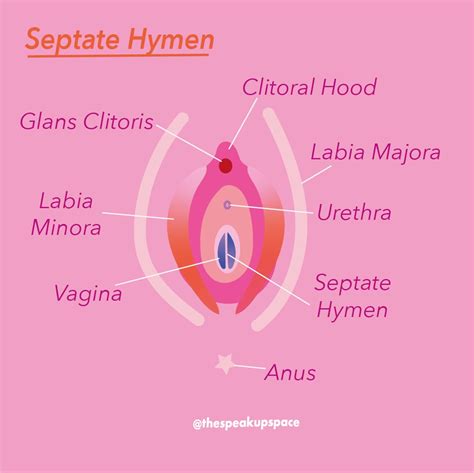 Septate Hymens