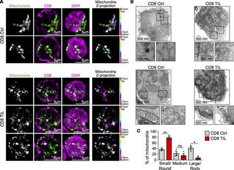 Jci Insight Mitochondrial Dysregulation And Glycolytic Insufficiency