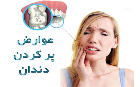 عوارض پر کردن دندان و دلایل آن دکتر سیده مریم حاکم زاده
