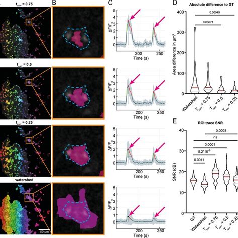 temporal correlation based roi detection a rois obtained using