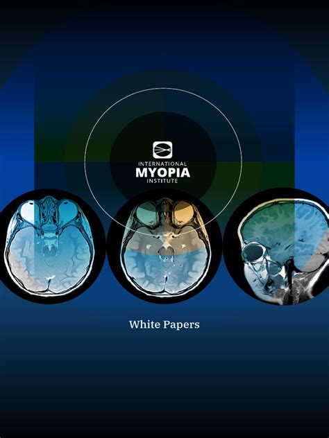 1 Imi White Papers Book Pdf Optometry Myopia