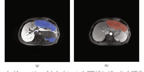 figure 7 from deep learning combined with radiologist s intervention