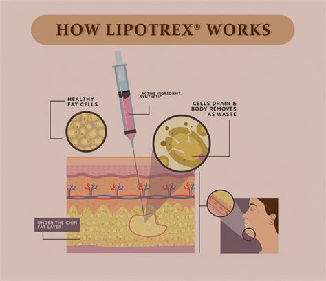 Lipotrex Smooth Lipolytic Solution Dermax