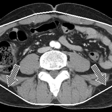 Result Of The Application Of The Convex Hull Algorithm And Threshold