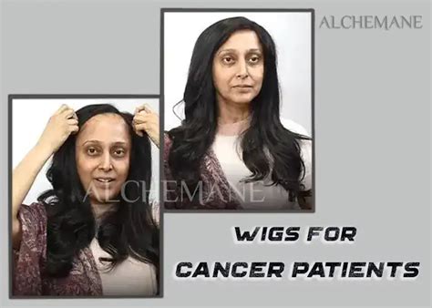 5 Things To Know About Wigs For Cancer Patients