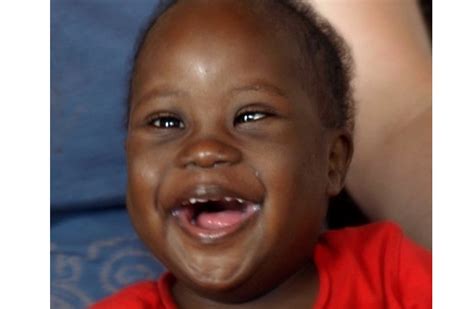 Health What You Should Know About Down Syndrome