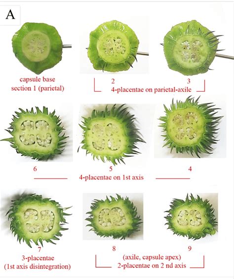 Diagram Showing Placentation Displacement From Parietal Capsule Base