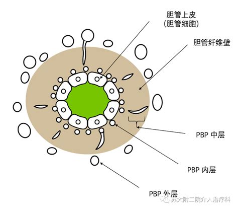 文献速递（第575期）—胆管坏死的病理生理学和影像学发现：肝肿瘤经动脉治疗的罕见但严重的并发症 1 血管