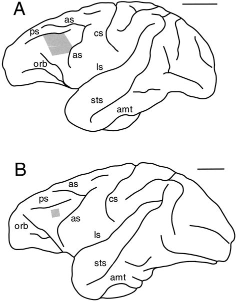 Middle Temporal Sulcus