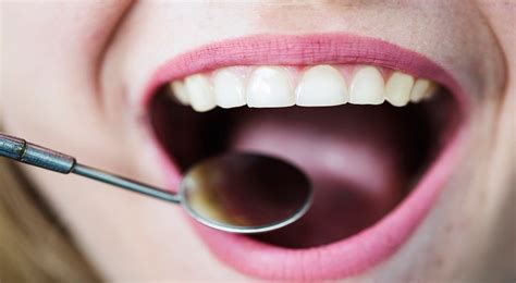 Understanding Oral Cancer Causes Risk Factors And Prevention